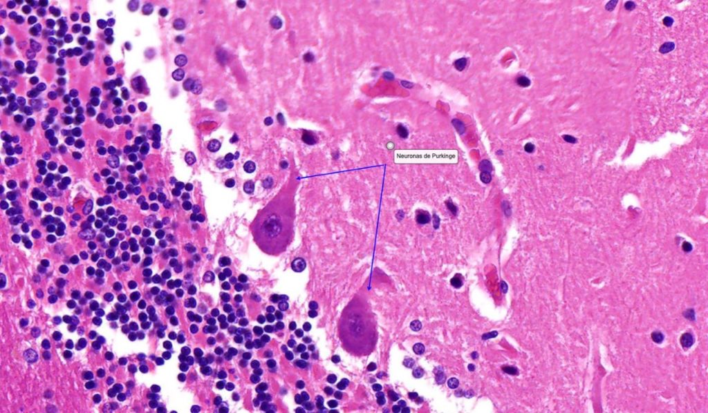 Neuronas - Laboratorio de biología Interactiva