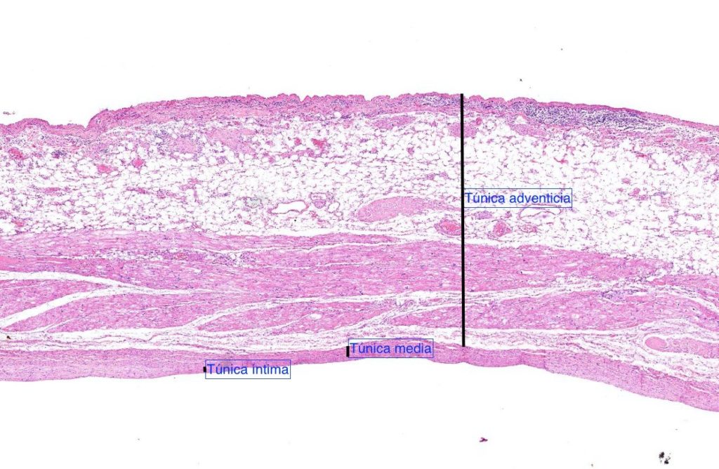 Vena Cava - Laboratorio de biología Interactiva